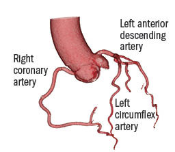 A safer way to diagnose coronary artery disease? - Harvard Health
