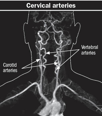 Severe neck pain: A signal of something serious? - Harvard Health